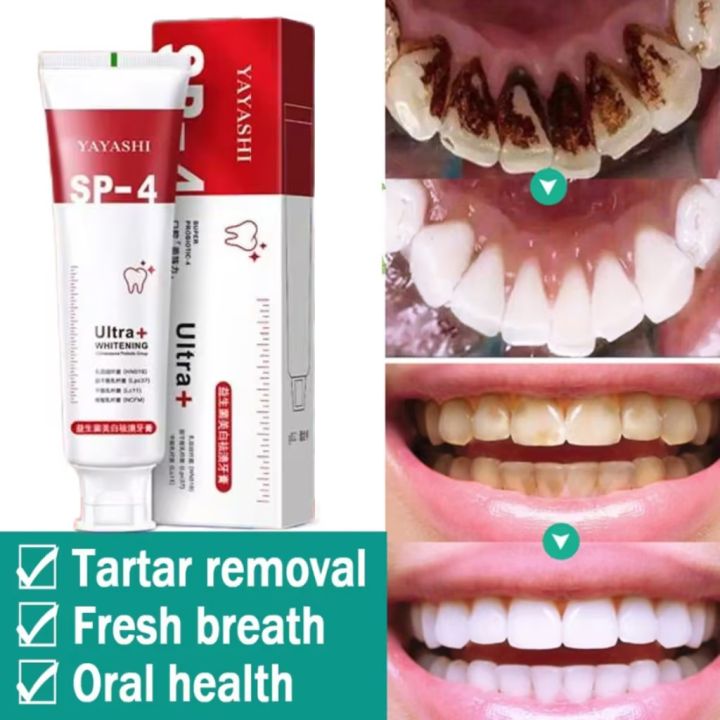 Probiotics Whitening Refresh Toothpaste Oral Shark Toothpaste Whitening ...