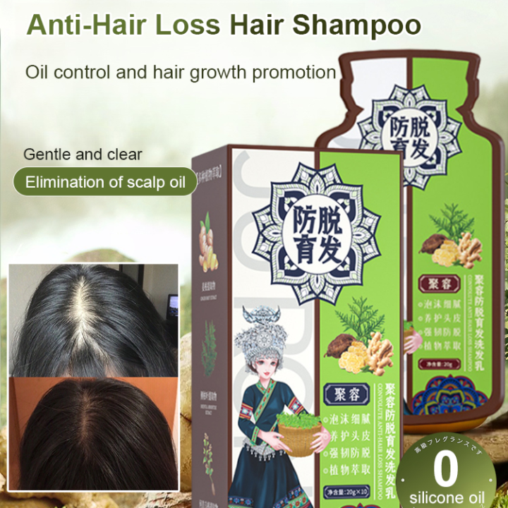 suidi123【Oil Control/Hair Growth】Ginger Plant Extract Anti-Hair Loss ...