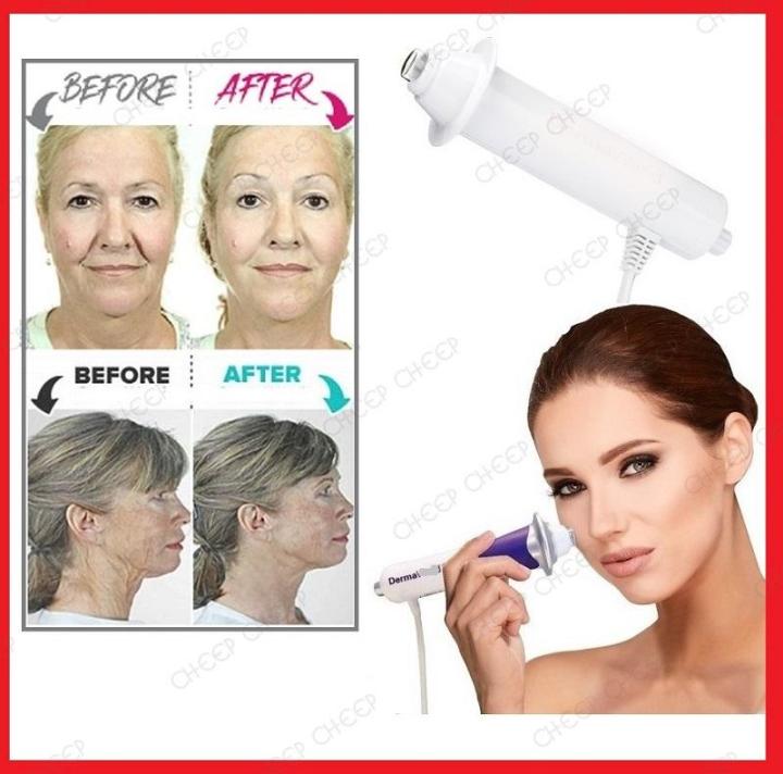 Anti-Aging Facial Device Derma Young Pro Microcurrent + RF Radio ...