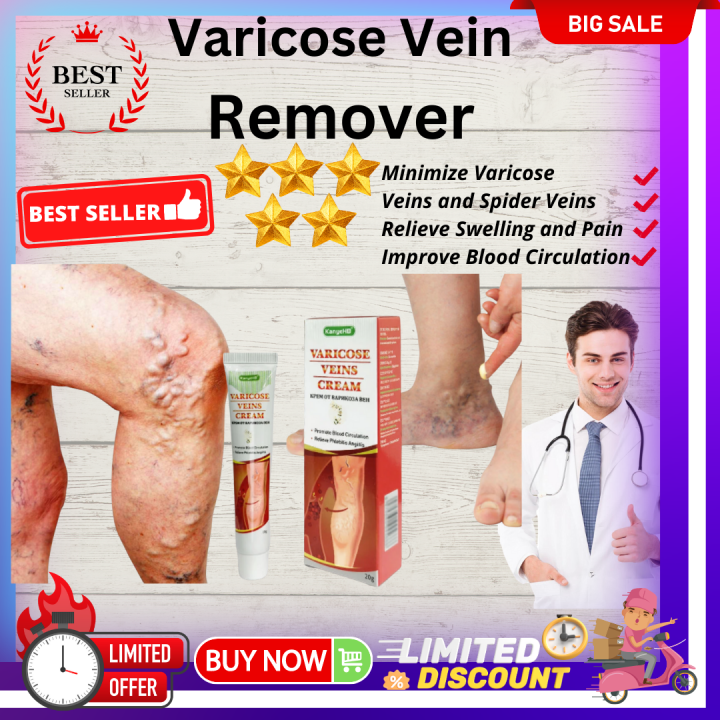 ️【 COD】KanyeHB Varicose Vein Remover Effective Original Varicose Vein ...