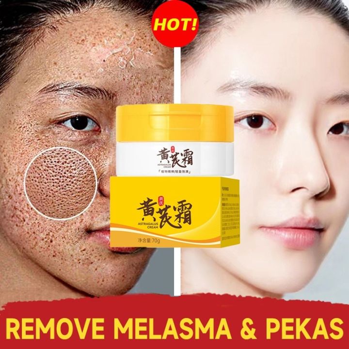 Astragalus Cream Krim Muka Moisturizer Cream Anti Wrinkle Improves ...