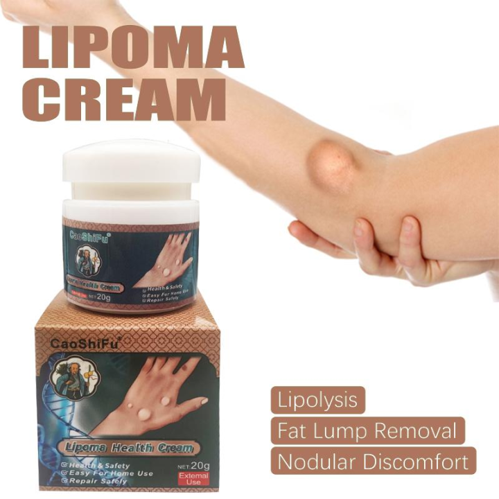 Original CaoShiFu Lipoma Health Cream Fat Lump Fibrous Lump Lymph Nodes ...