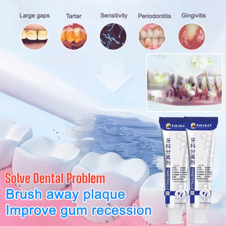 Dental Separator Toothpaste Shrinkage Repair Calculus Removal ...