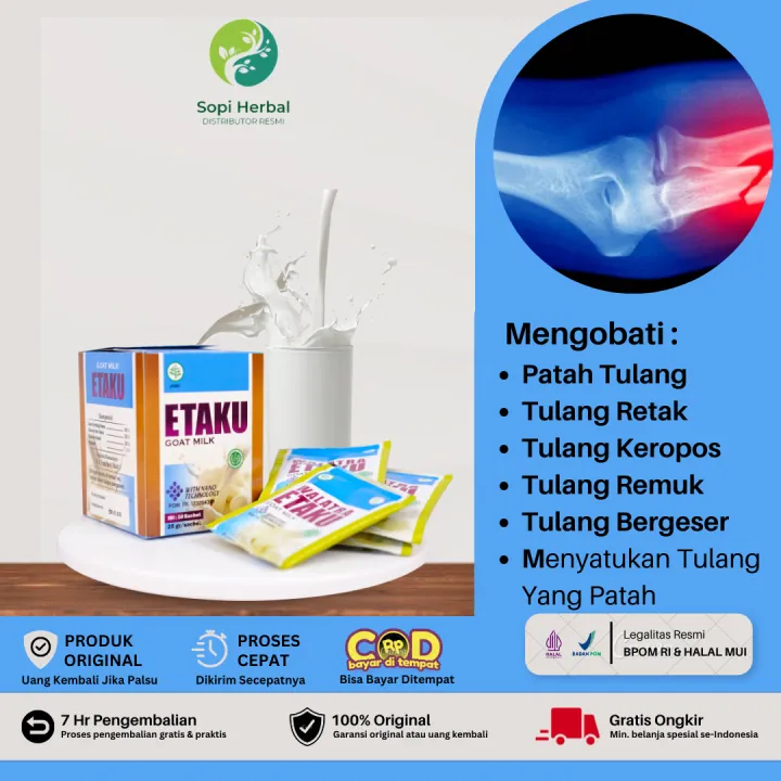Obat Patah Tulang, Obat Patah Tulang Akibat Jatuh Kecelakaan, Tulang ...