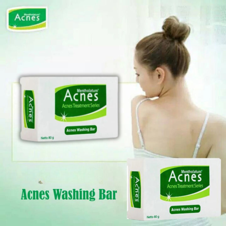 ACNES Washing Bar Netto 80 Gr | Lazada Indonesia