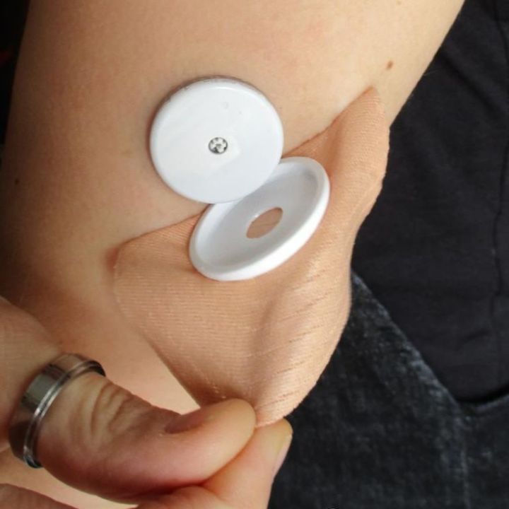 Disposable 5 ชุด Freestyle Libre Sensor Protector สำหรับการเปลี่ยนแพทช์ ...