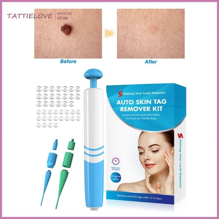 MAFFICK 2 in 1 Automatic Wart Spot Removal Kit Painless Facial Plantar ...