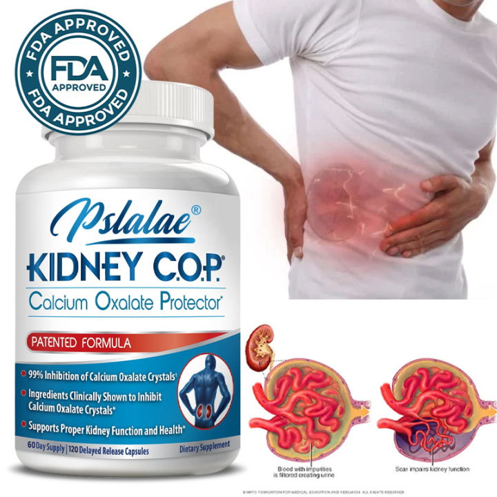Kidney COP Calcium Oxalate Capsules - Patented Formula Calcium Oxalate ...