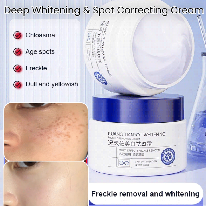 Deep Whitening & Spot Correcting Cream Freckles Removal Cream ...