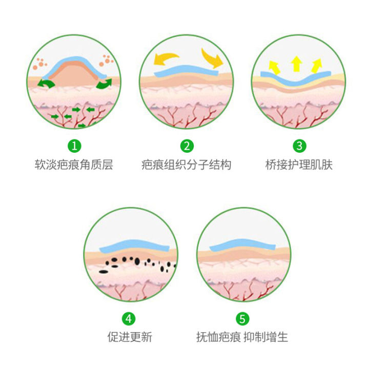 Shunaimei adhesive scar paste for inhibiting and preventing scar ...