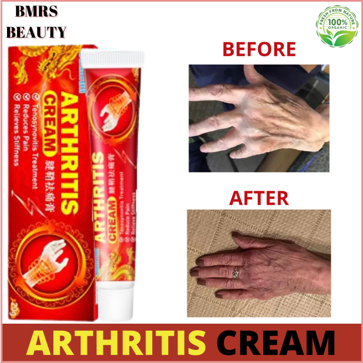 AUTHENTIC AND BEST Arthritis Ointment Joint Pain Relief Cream Easy to ...