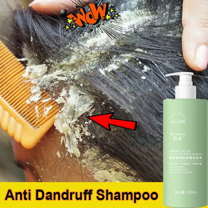 Anti Dandruff Shampoo Oily Scalp Shampoo 500ML Antibacterial Dandruff ...