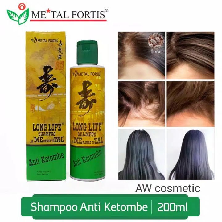 METAL FORTIS Shampo Metal 200 Anti Dandruff Long Life Shampoo Anti ...
