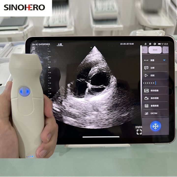 Sinohero 64E Handheld Wireless Color Ultrasound Doppler Phased Array ...