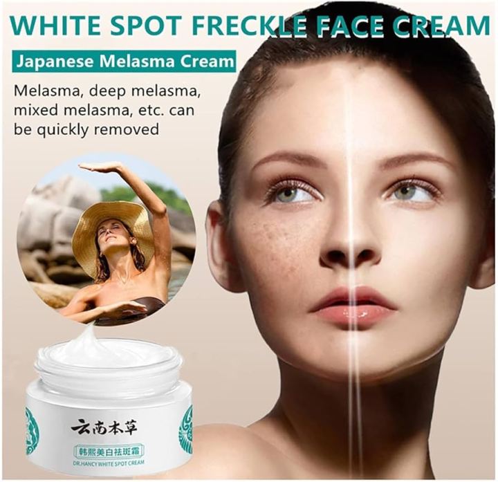 Original Japanese Melasma Cream High Moisturizing Cream Blemish Cream ...