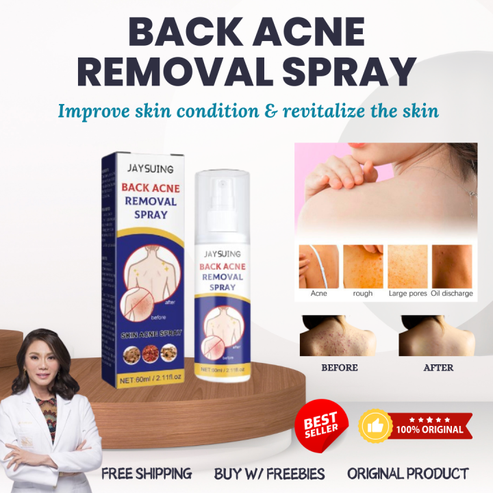 Original Back Acne Removal Spray, remove scar & Dark Spot Fade, Body ...