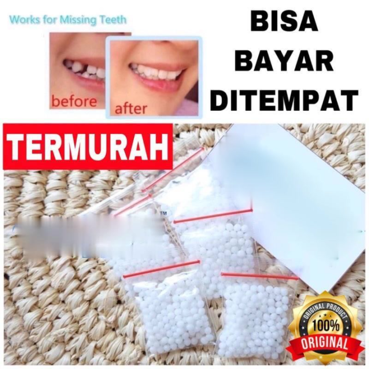 GIGI PALSU 100 BUTIR PENAMBAL GIGI PATAH RENGGANG TEMPORARY TOOTH ...