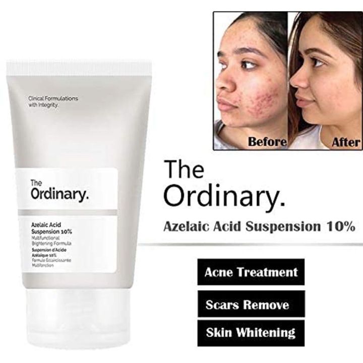 Original TCM Scar Removal Gel Acne Pimples Stretch Marks Keloid Remover ...