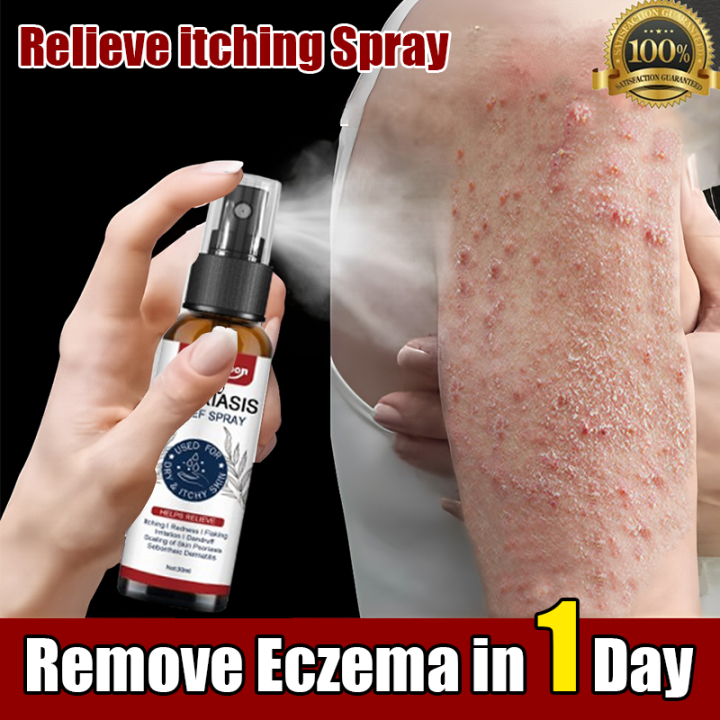 Eczema and psoriasis treatment spray for skin diseases antifungal, anti ...