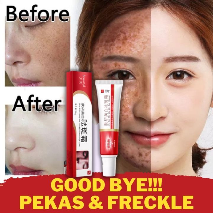 Original Japan & Freckle Removal Whitening Cream Darkspot Remover Cream ...