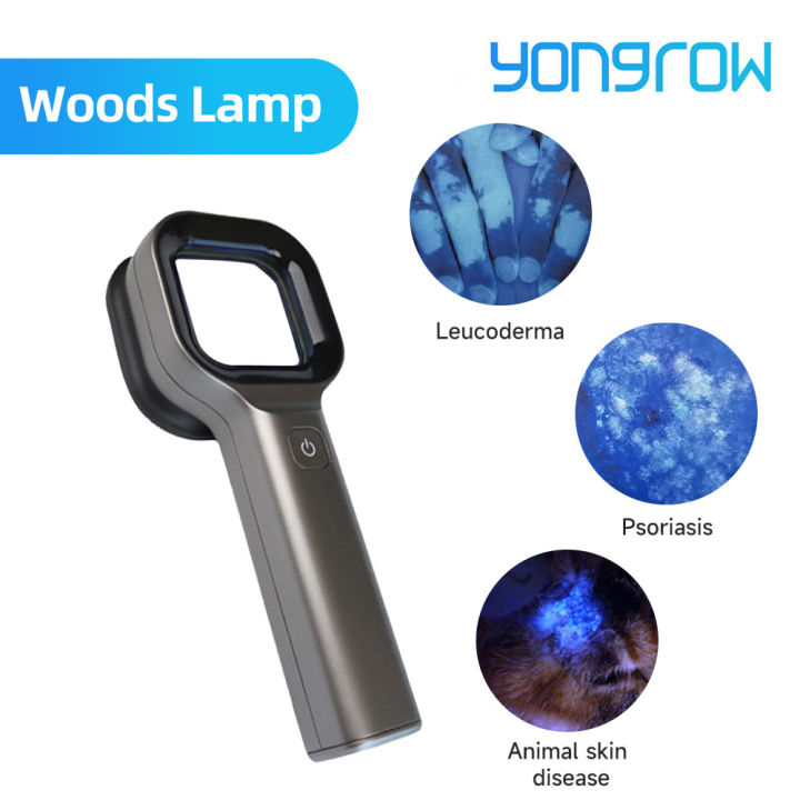 Yongrow Medical Woods Lamp Skin Examination Skin Fungus Detector ...