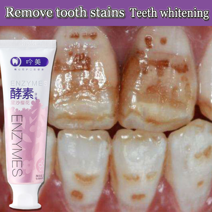 Whitening Toothpaste baking soda toothpaste120g Whitening Peppermint ...