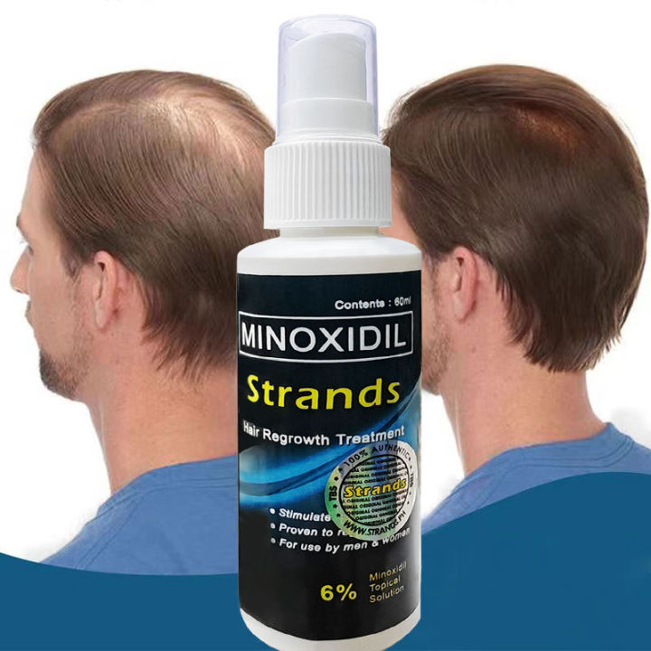 Minoxidil Strands 6% Hair Loss Treatment Hair Grower Beard Grower ...