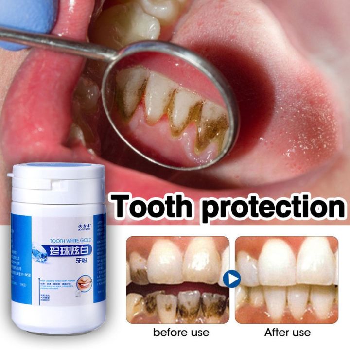 Whitening removing yellowing removing smoke stains removing bad breath ...