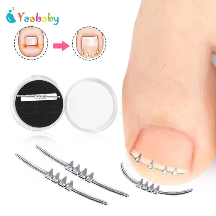 Pedicure Recover Embed Toe Nail Care Straightening Correction Clip ...