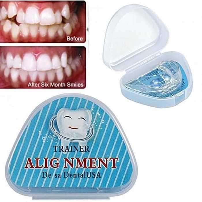 ALAT PERAPI GIGI / PERAPIH GIGI / TEETH RETAINER / Orthodentic Retainer ...