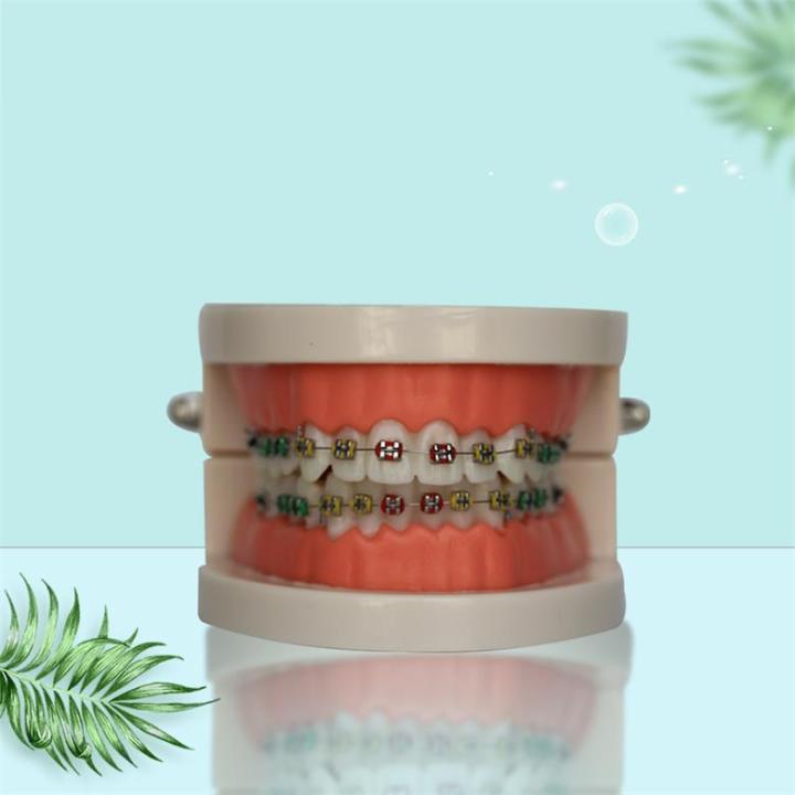 Dental Correction Model Orthodontic Dental cast Cermet Comparison cket ...