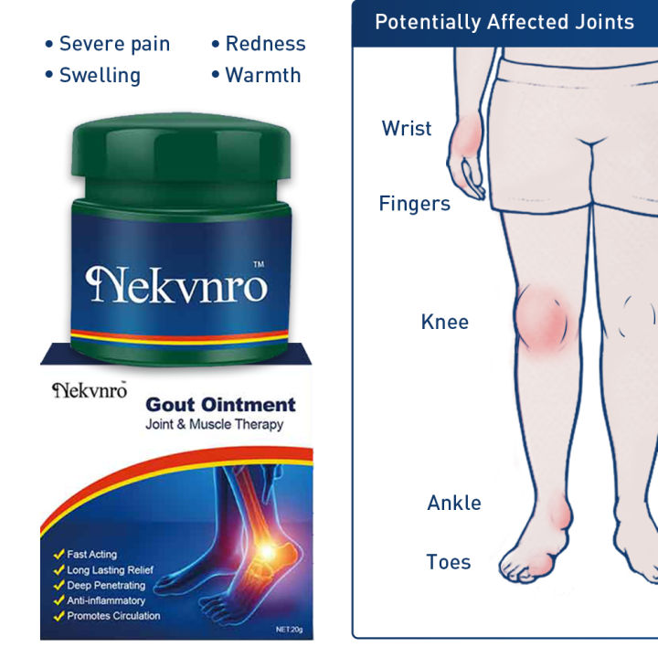 AMEIZII Ubat Gout Ointment Chinese Herbal Gout Medicine 100% Effective ...