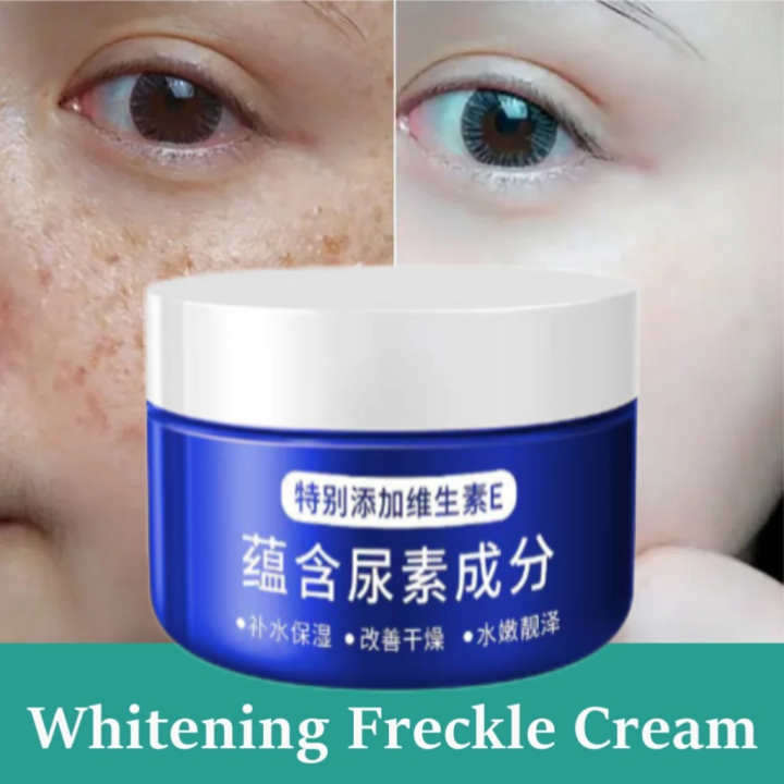 Pekas Remover 100% Effective and Original Whitening Freckle Cream ...