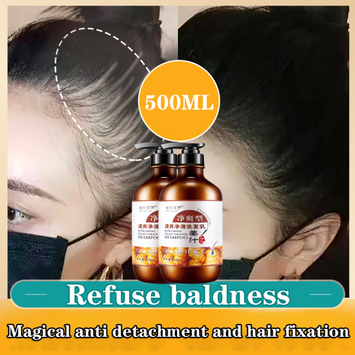 Ginger shampoo anti hair loss and hair fixation flagship store official ...