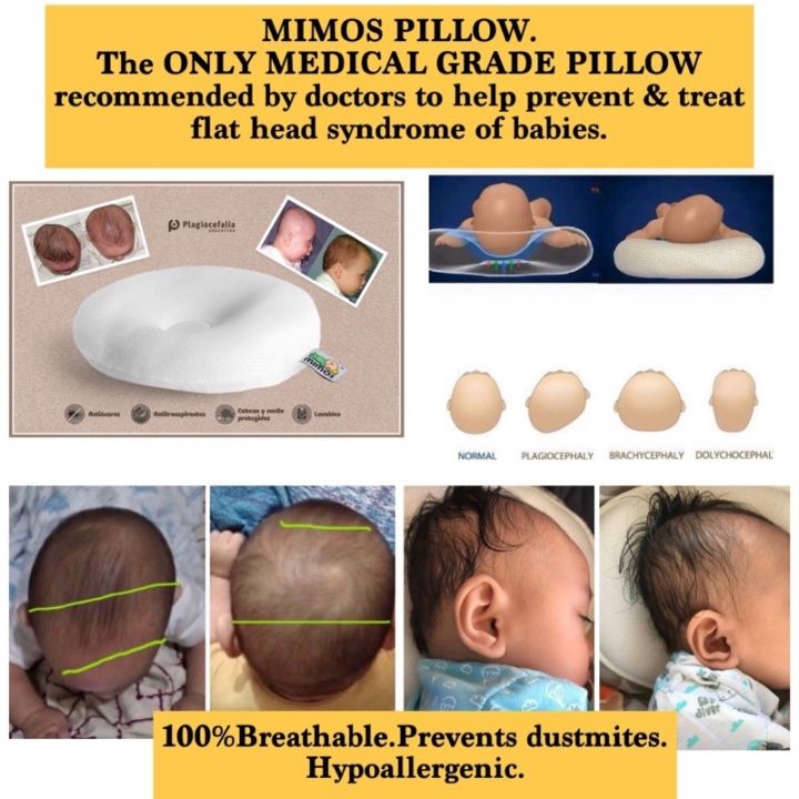 Infant Pillow Flat Head Syndrome