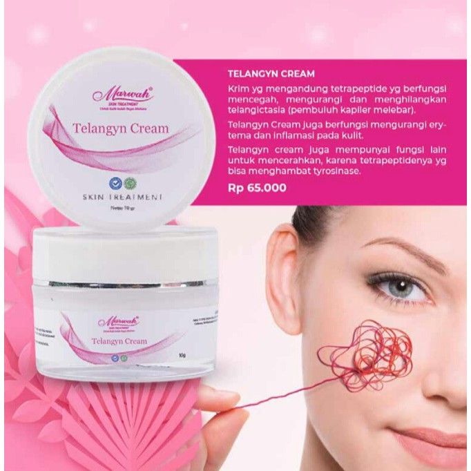 Marwah Telangyn Cream Ori - Krim Ampuh Memudarkan Urat Urat Merah Di ...