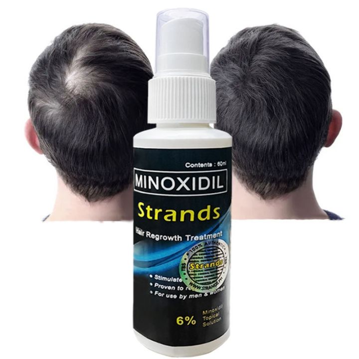 Minoxidil strands 6% original Minoxidil Topical Solution Hair Grower ...
