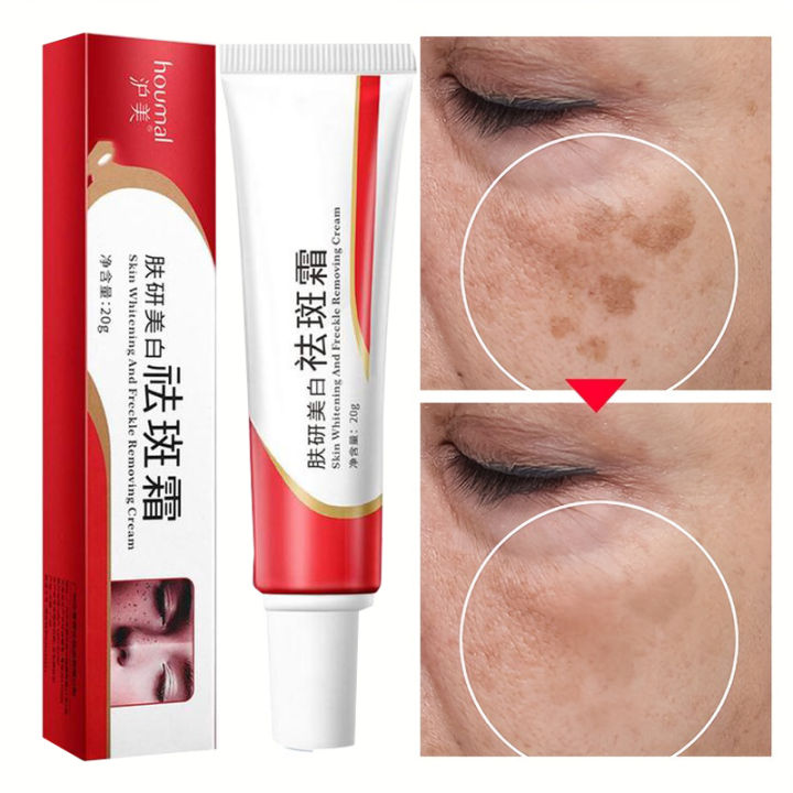 Whitening & Freckle Remover Cream remove dark spots on face melasma and ...
