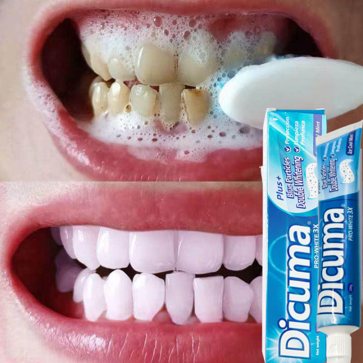 100g Whitening Peppermint Food Graded Healthy Family Size Toothpaste ...