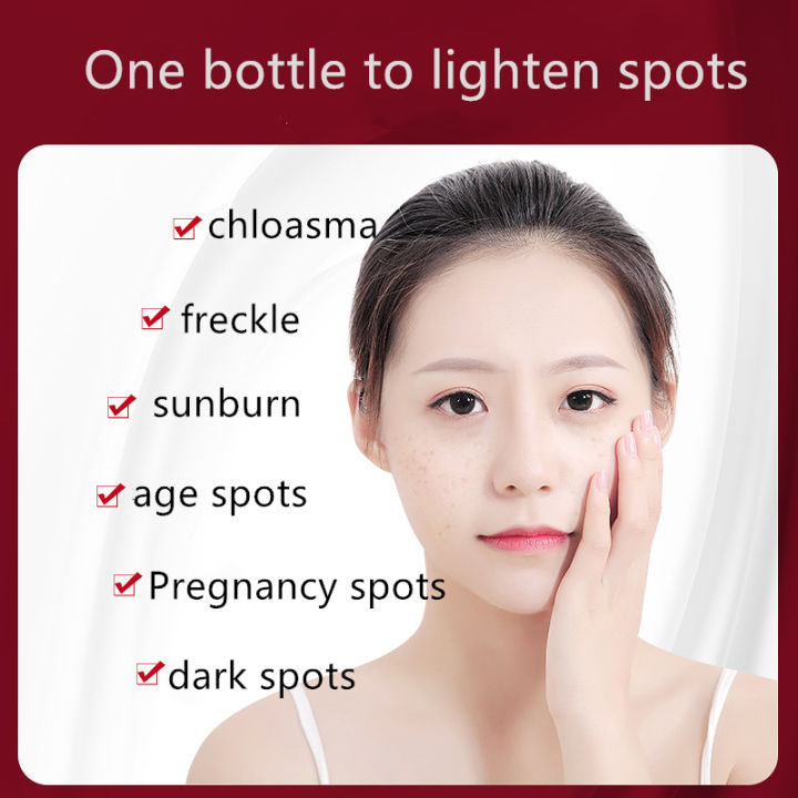 freckle cream skin whitening cream melasma remover cream whitening skin ...