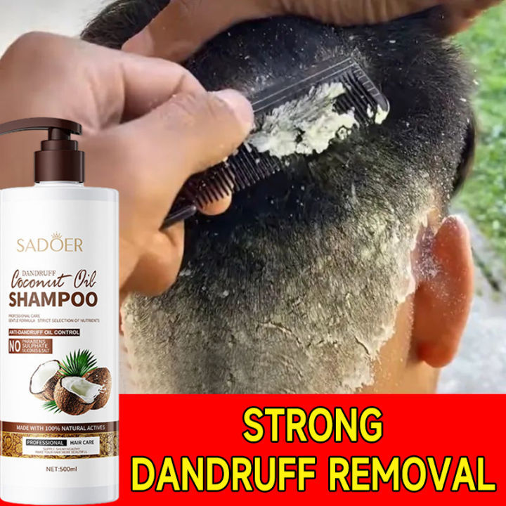 Oil Control Shampoo Repair Smooth Shampoo with Amino Acid Complex Scalp ...