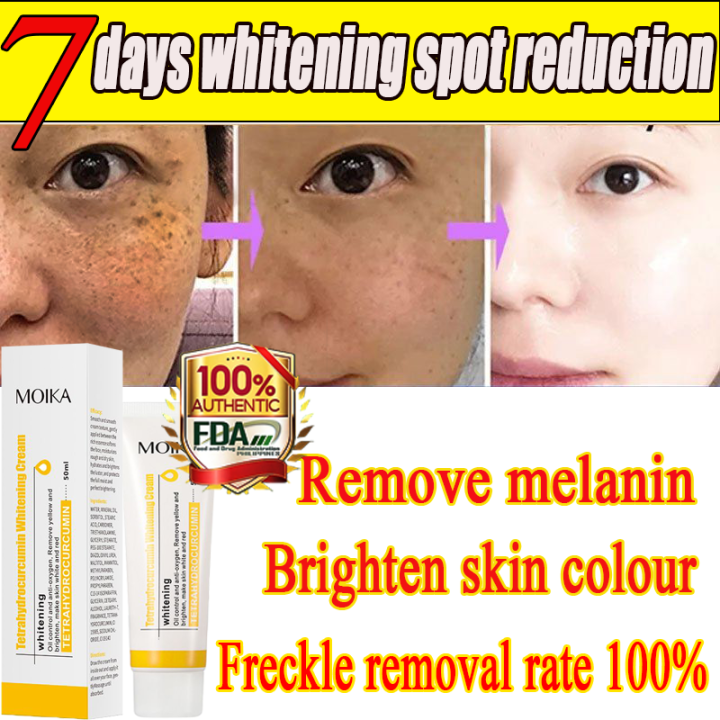 100% Effective Japanese Melasma Cream Lighten Melanin Brighten ...