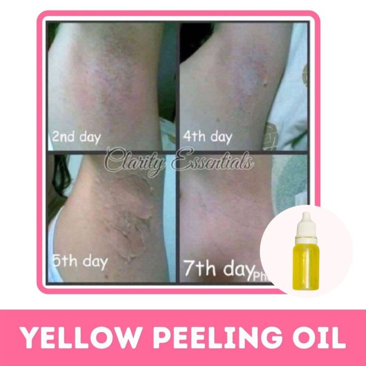 Underarm Peeling Oil 15 ml (Yellow Peeling Oil) by Clarity Essentials ...