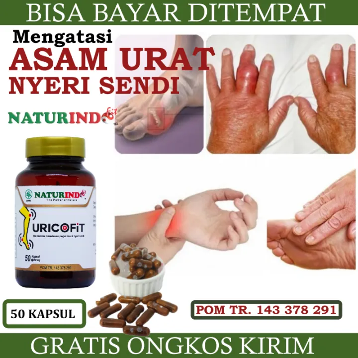 Obat Asam Urat, Nyeri Sendi, Kaki Bengkak, Kaki terasa Panas, Rematik ...
