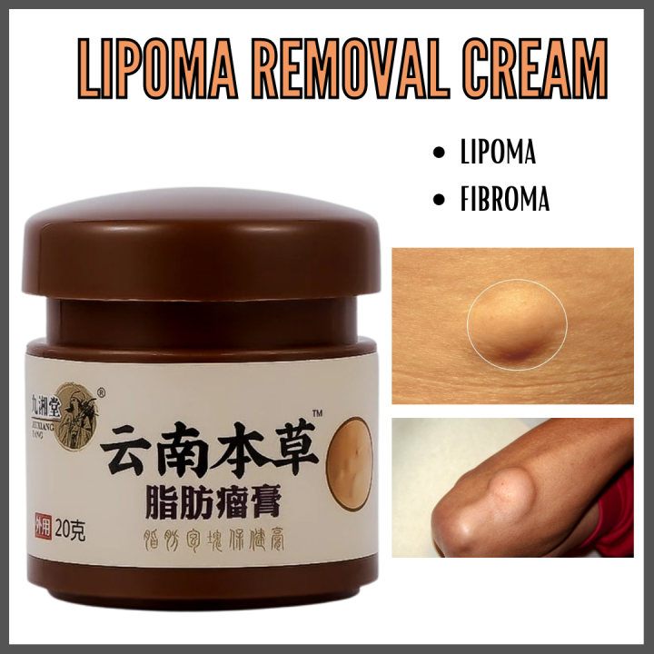 "20g Herbal Ointment for Lipoma Removal: Natural Treatment for Tumor ...