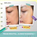 Implora How Does It Peel - Peeling Gel AHA BHA Aloe Vera Collagen ...