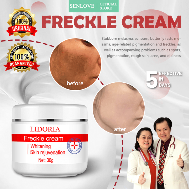 SENLOVE japanese melasma cream original face whitening pekas remover ...