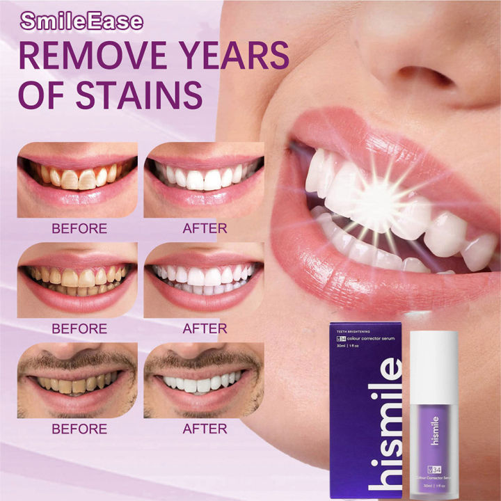 Smile Ease Toothpaste V34 teeth whitening color corrector teeth colour ...