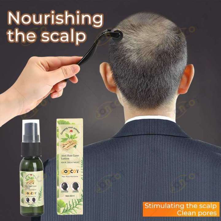 ORIGINAL Ginseng Root Extract Anti Hair Loss Lotion Hair Treatment Hair ...