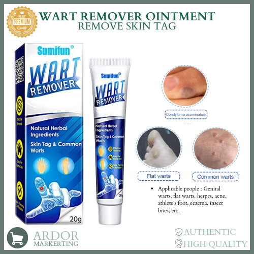 WART REMOVAL OINTMENT - No Pain Warts Remover All Skin Types - Skin ...